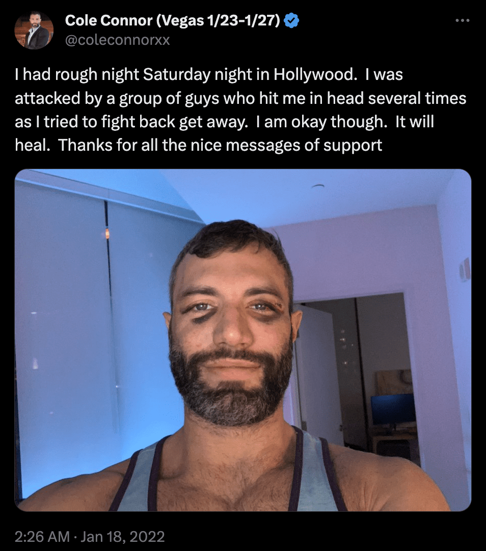 Cole Connor Was Beaten And Mugged By A Group Of Six Thugs In Hollywood ...